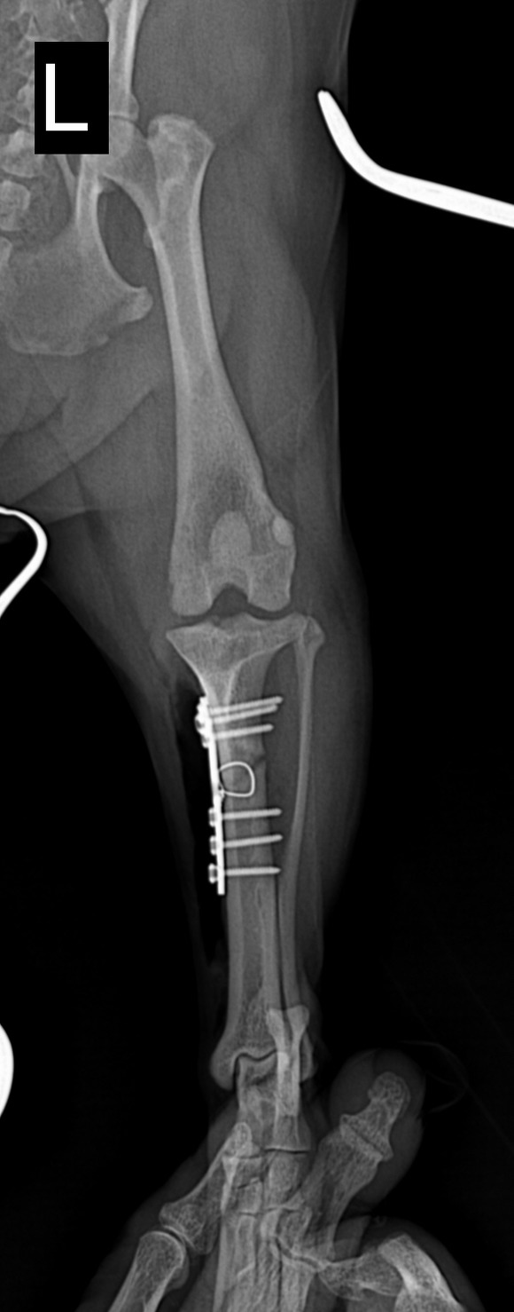 TPLO /cTWO /CBLO/Anti-rotation 전십자인대 파열/단열수술 - ─… [병원소개] - 청주 안과 골절 정성환 ...