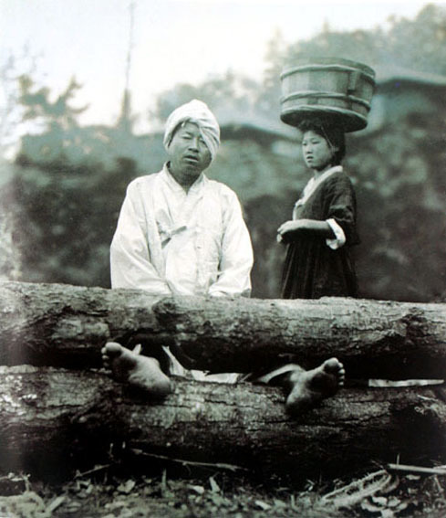 거라사(Gerasenes),거라사인,거라사인의 지방,가다라(Gadarenes)/쇠사슬(Chain),고랑,착고(차꼬Stock ...