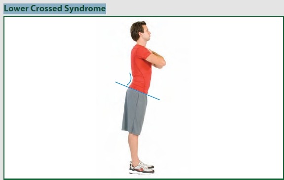 lumbar-pelvis-hip compex overhead squat, one leg squat 검사결과와 치료법 - 정리중 ...