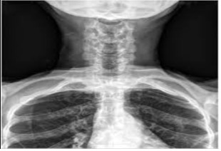 Hobb's view 다시 올립니다! - GMH 촬영 - 굿모닝영상의학과