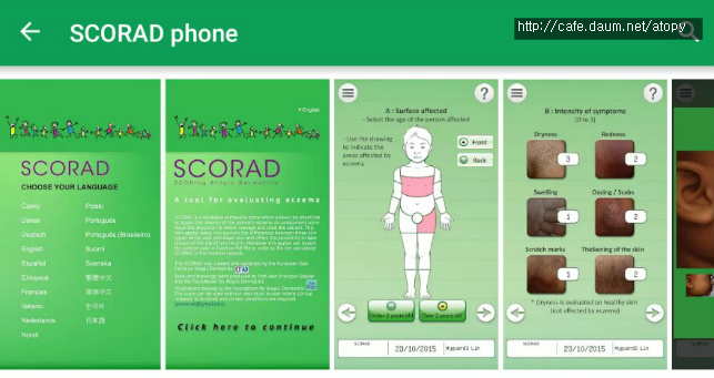 SCORAD 점수 체크하는 방법 - SCORAD 점수 체크 - 아토피 학교