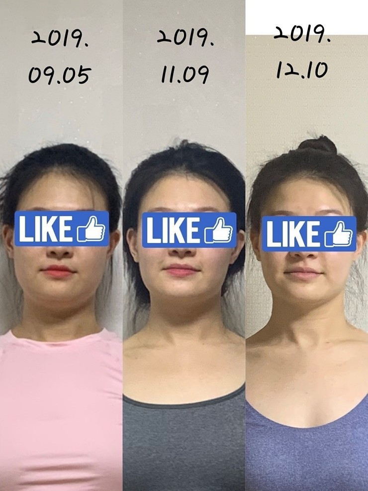 [96기 이보배] 나에게 너무 값진 100일 - SNPE 바른자세,척추교정,다이어트운동 체험사례ⅱ - SNPE 바른자세 척추교정운동(휜다리/체형교정,통증완화)